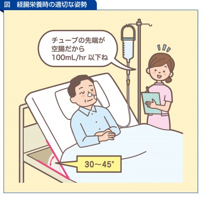 小腸 逆流 対処 forcesuppo