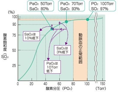 spo2とsao2の関係 | pao2 sao2 換算 – LUSAB